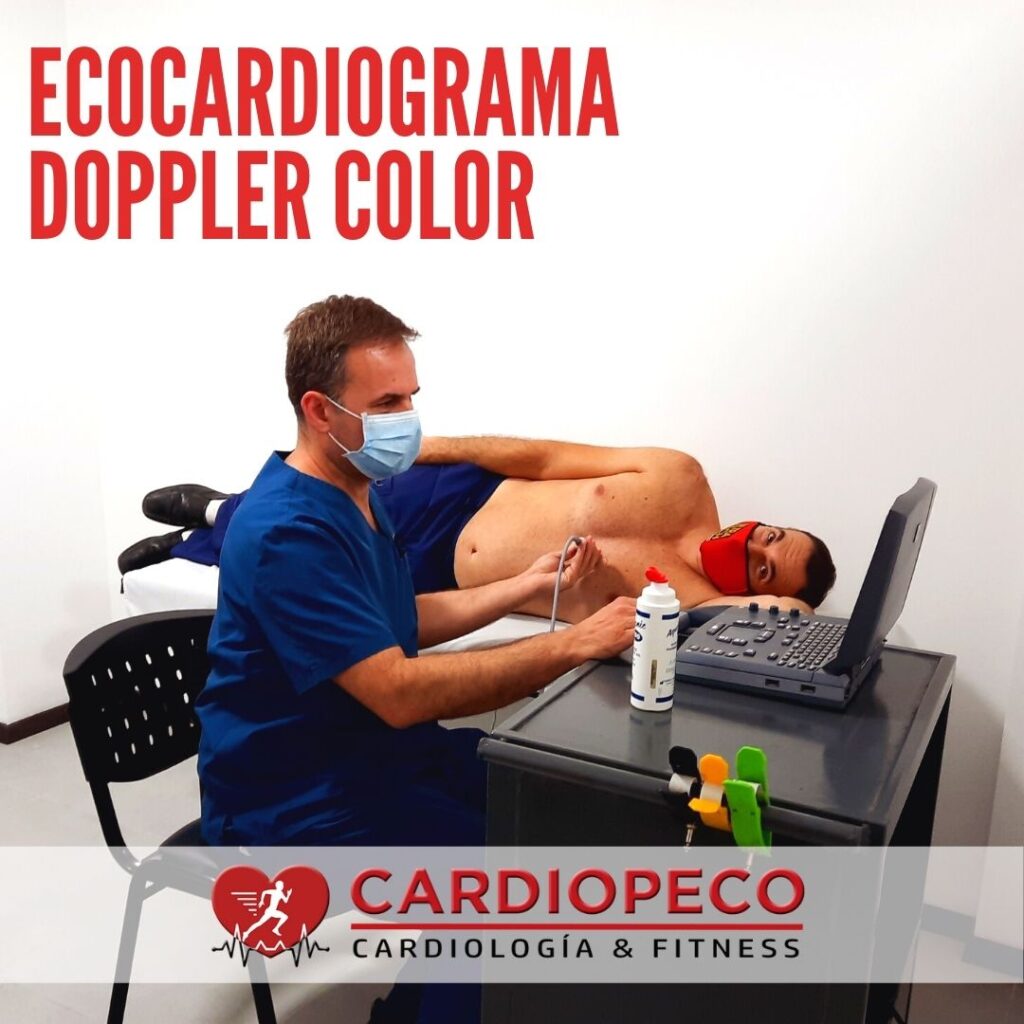ECOCARDIOGRAMA DOPPLER COLOR - Cardiopeco